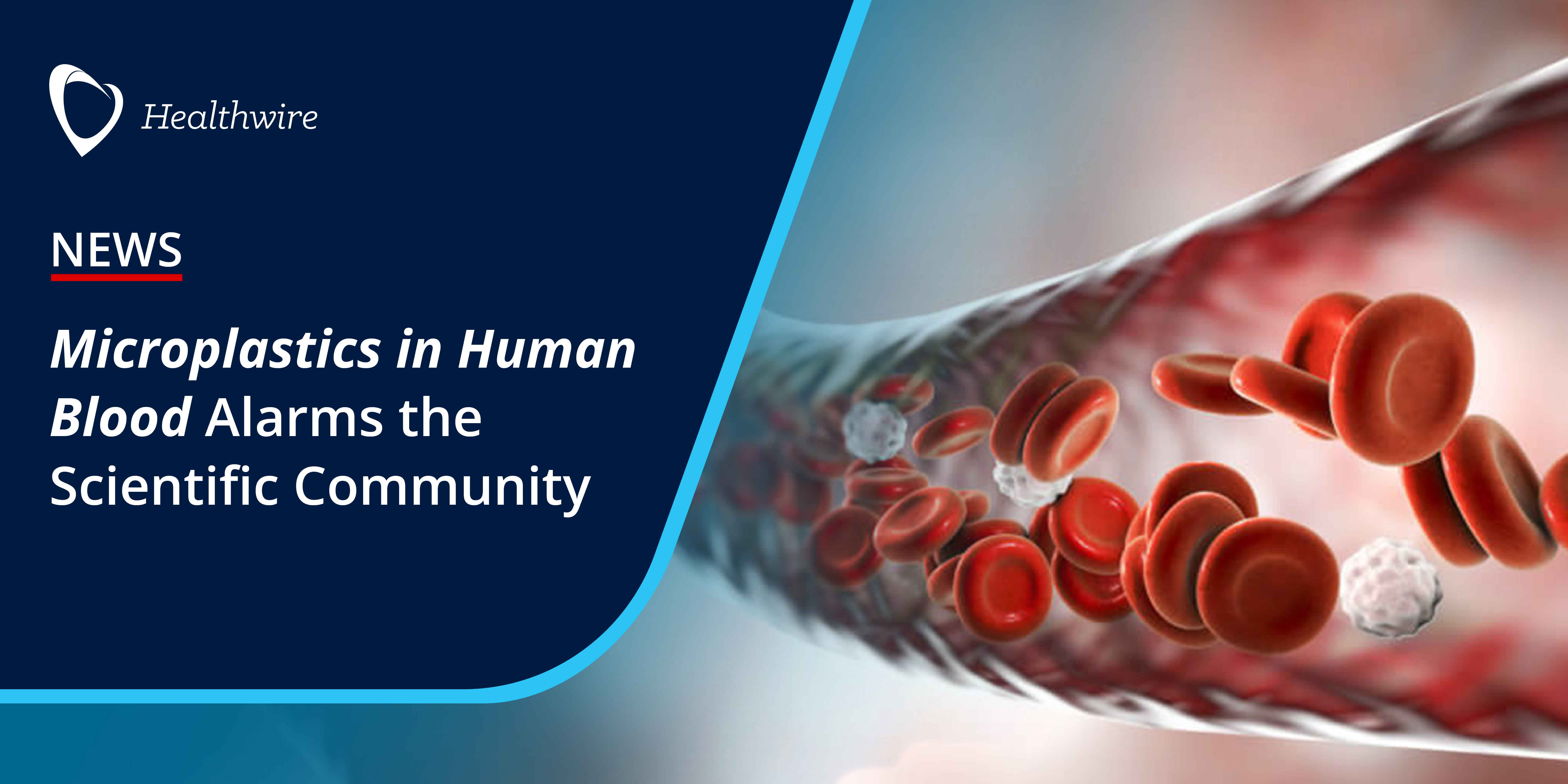 Microplastics In Human Blood Alarms The Scientific Community ...